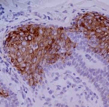 Cytokeratins – markers in tumour diagnostics - EXBIO Antibodies
