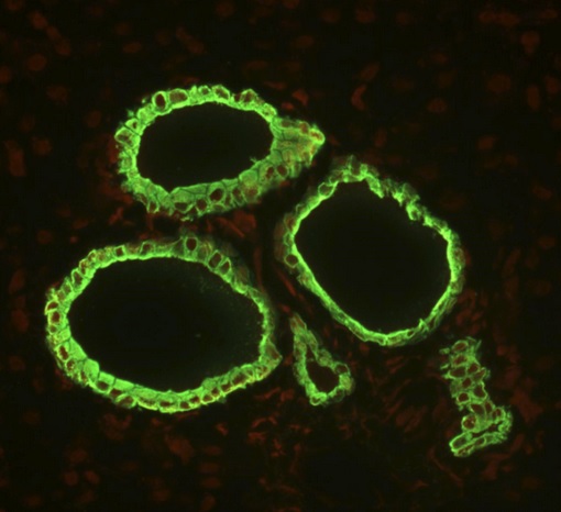 Cytokeratins – markers in tumour diagnostics - EXBIO Antibodies