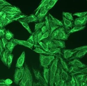 Cytokeratins – markers in tumour diagnostics - EXBIO Antibodies