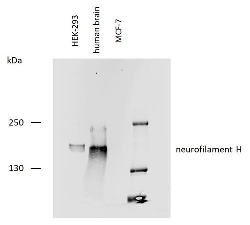 Anti-Neurofilament H Purified - EXBIO Antibodies